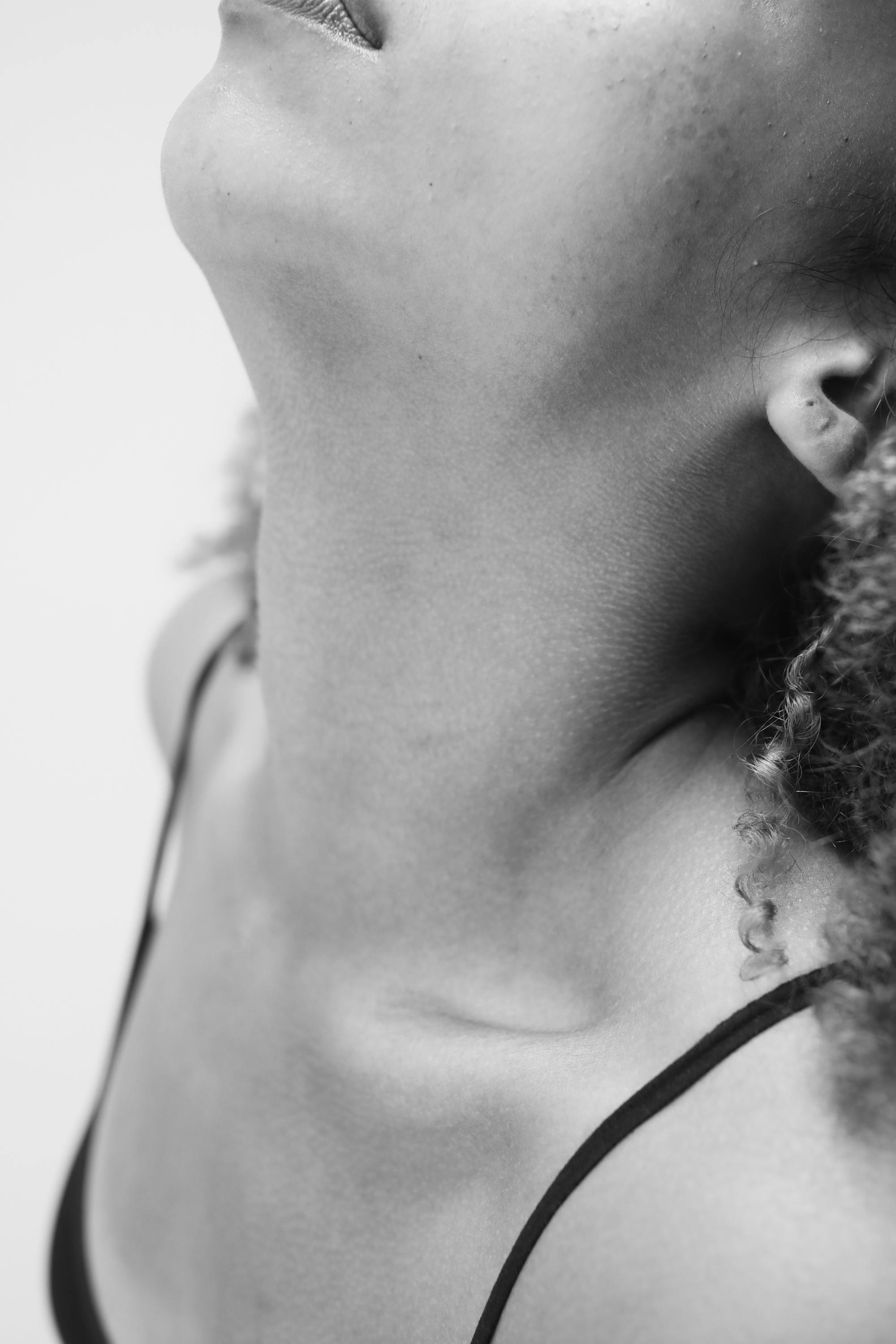 Electrolysis vs Laser Hair Removal and Hyperpigmentation - forurleisure